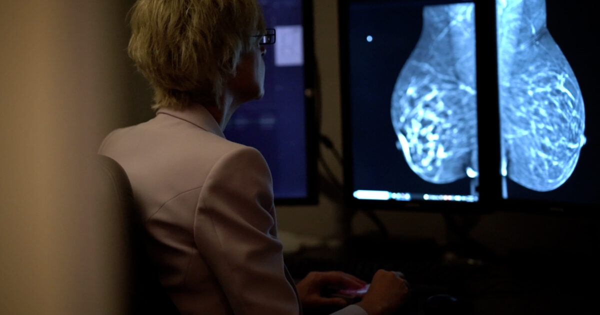 Breastscreen Sa Breast Density Reporting At All Clinics